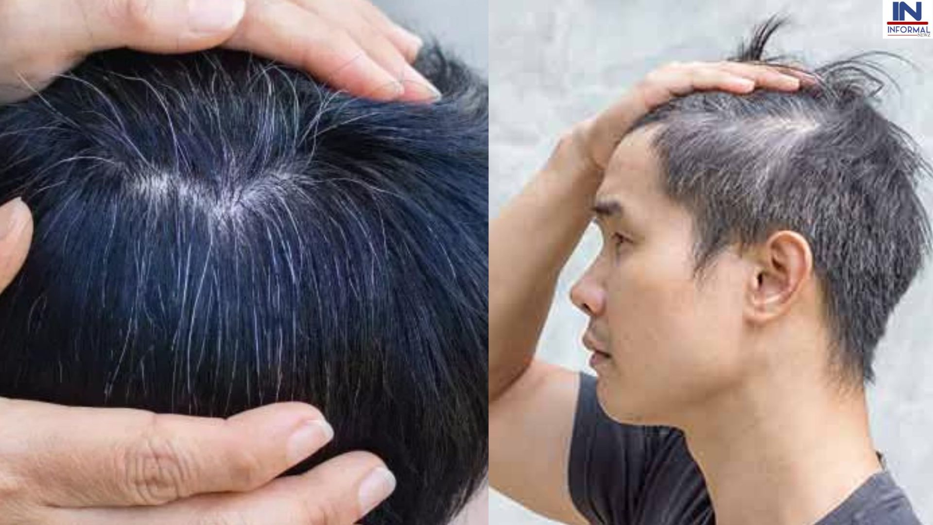 White Hair Solution with Ayurveda: कम उम्र में बाल हो रहें हैं सफेद तो ...